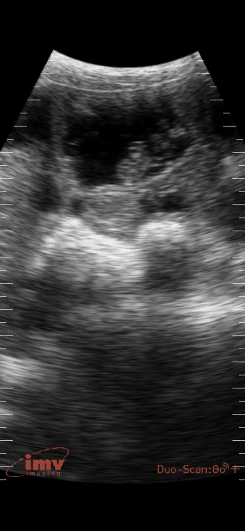 Sow pregnancy 33 days with Duo-Scan:Go | IMV imaging