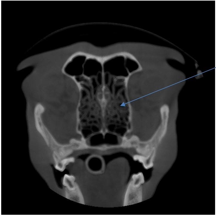 Motion in Head CT | IMV Imaging Academy
