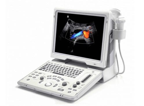 Mindray Z6 Ultrasound Product Support | IMV Imaging