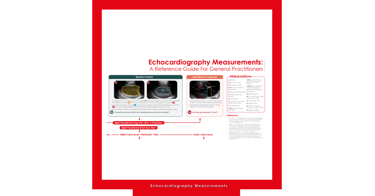 Echo Measurements Poster