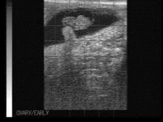 Confirmation de la viabilité du foetus | IMV Imaging