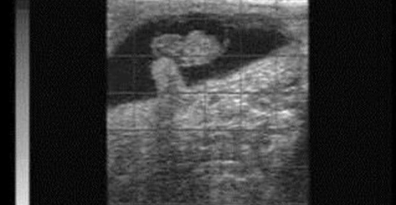 Confirmation of fetal viability in cattle | IMV imaging
