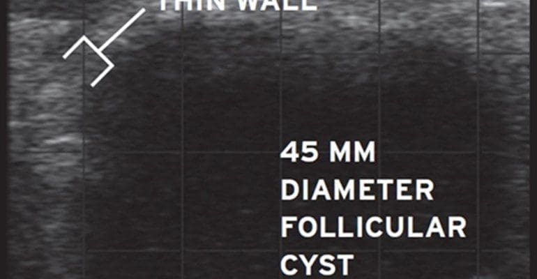 Identification twins in Cows | Vet Ultrasound | IMV Imaging