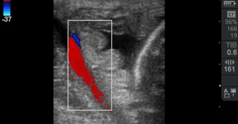 Doppler ultrasonography in equine reproduction | IMV Imaging