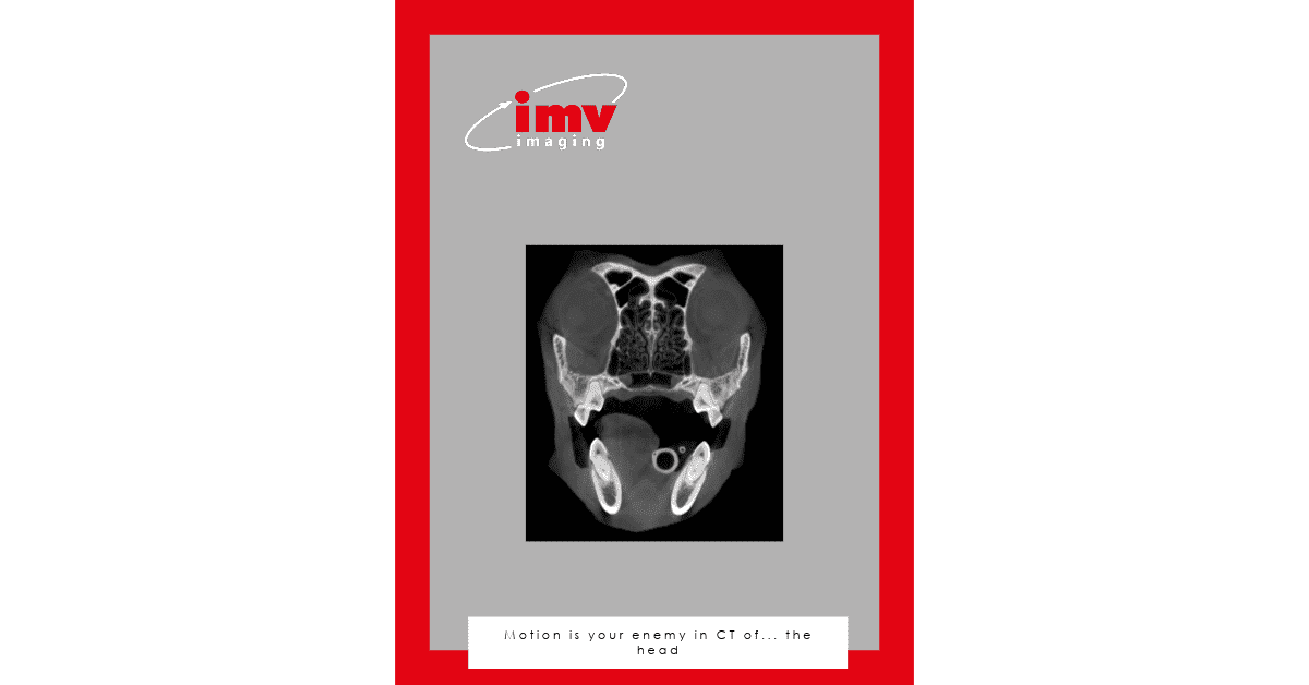Motion in Head CT | IMV Imaging Academy