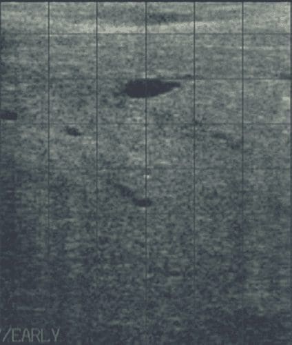 Udder Ultrasonography | Dairy Cattle | IMV Imaging Academy