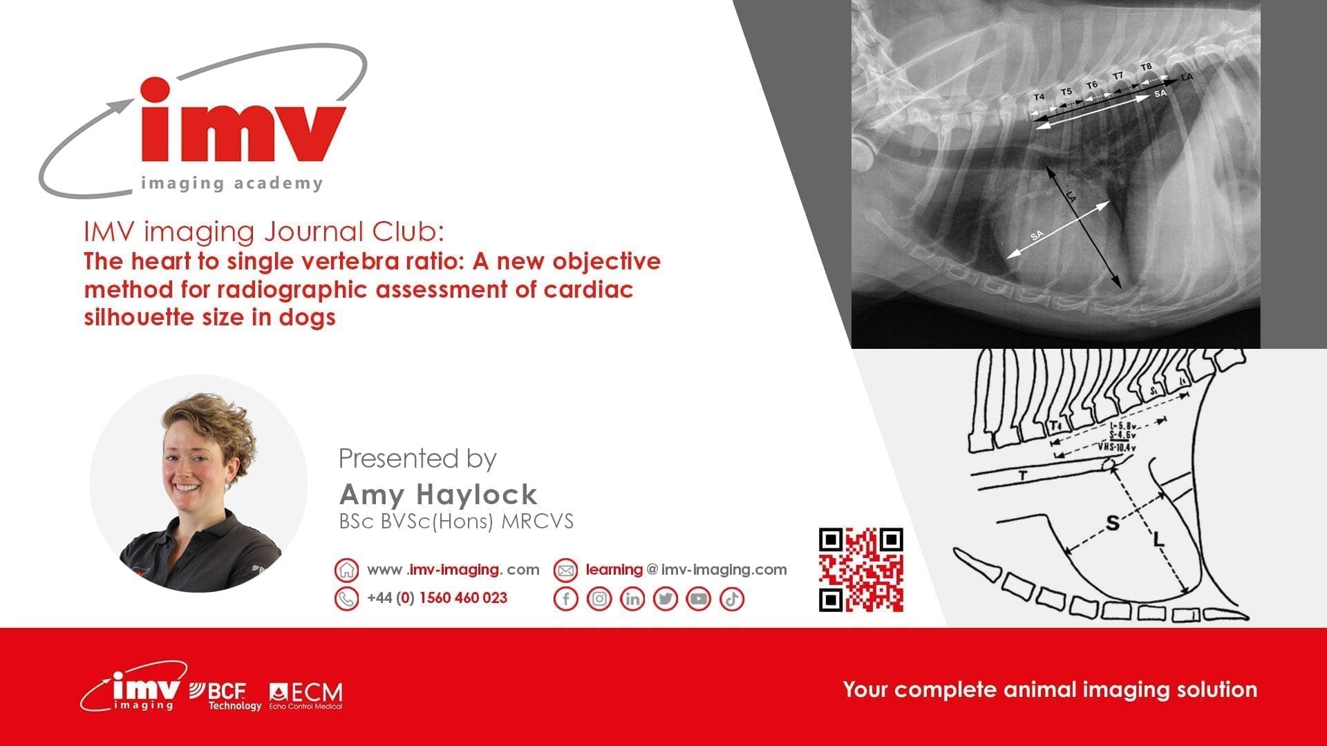 Journal Club: The Heart to Single Vertebra ratio (HSVR)