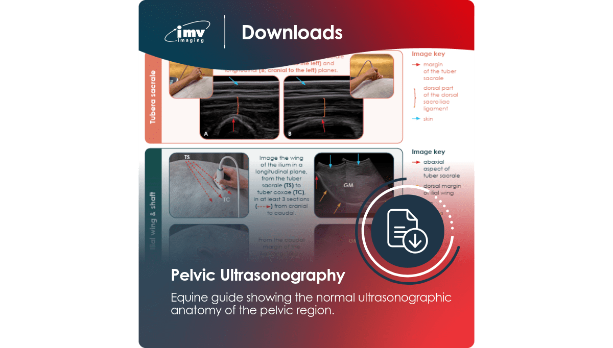 Free Download: Pelvic Ultrasonography Poster | IMV imaging