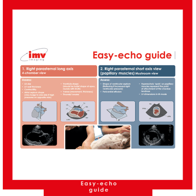 Journal Club: The Heart to Single Vertebra ratio (HSVR)