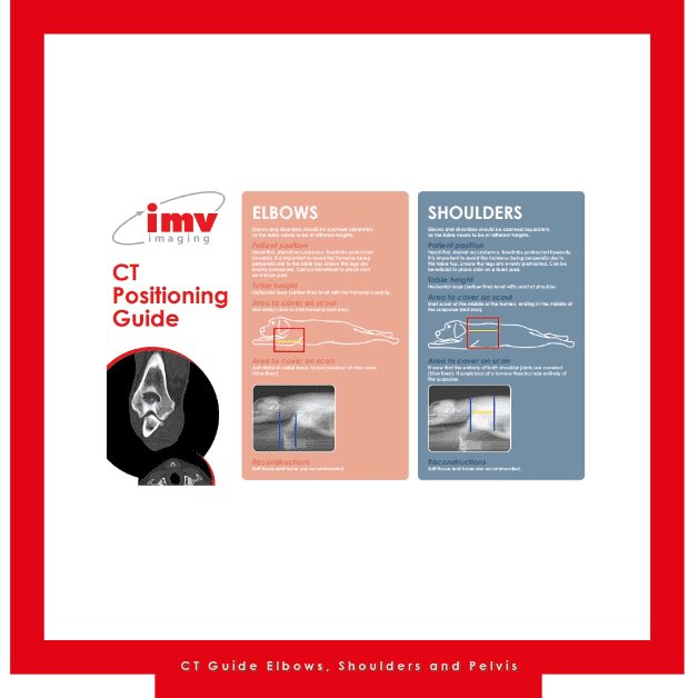 Free Download: Pelvic Ultrasonography Poster | IMV Imaging