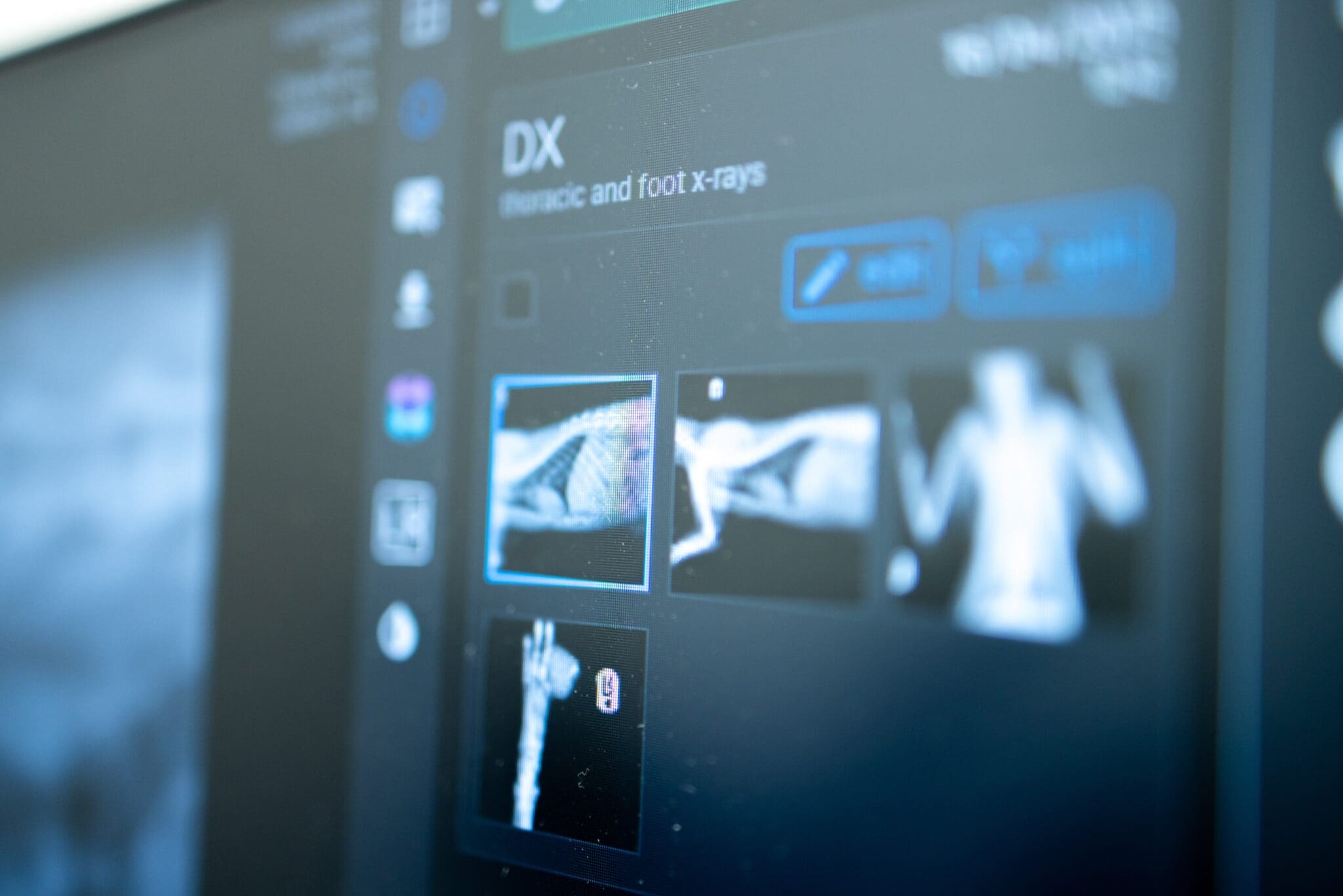 The Dental X-Ray 80/20 Rule: Are You Supporting the Right Cases? | IMV ...